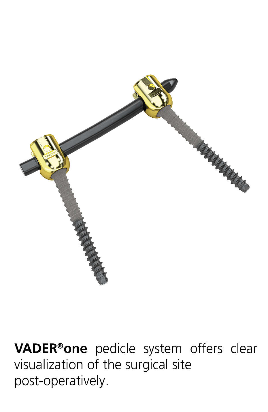 FDA Clearance: VADER®one Pedicle Screw System | icotec
