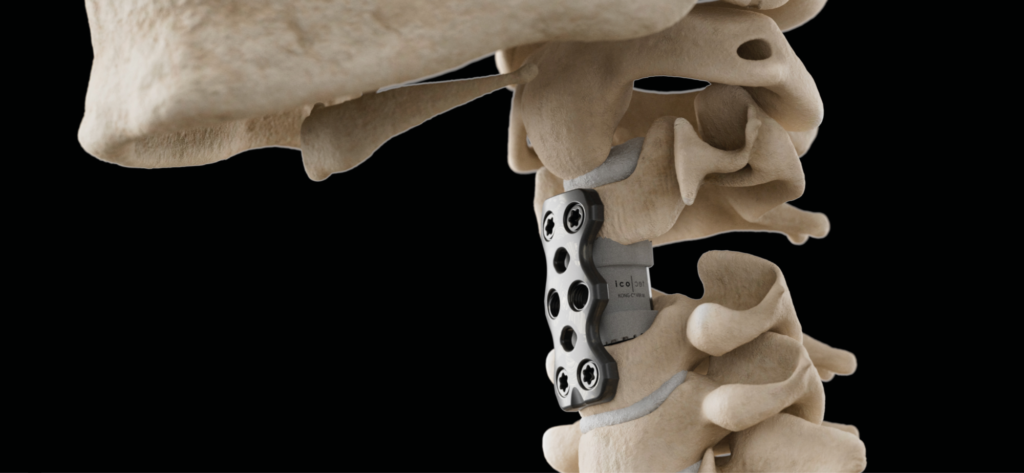 Cervical Plate System I icotec Anterior Cervical Plate