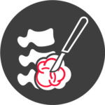 Optimized Perioperative Management | icotec