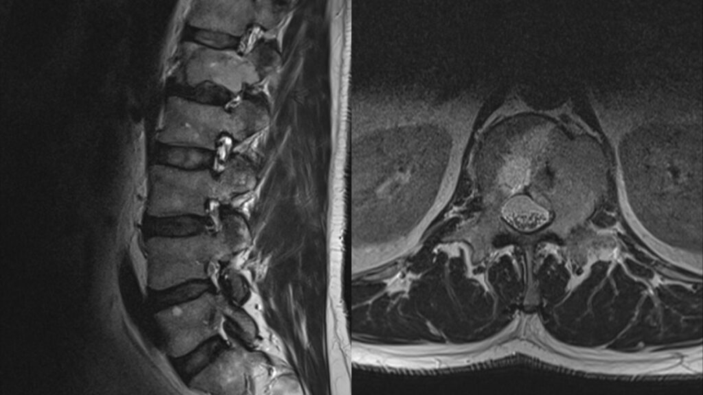 Advanced Radiation Therapy | icotec