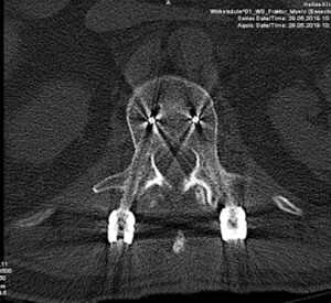 Expanded Therapy Options | icotec