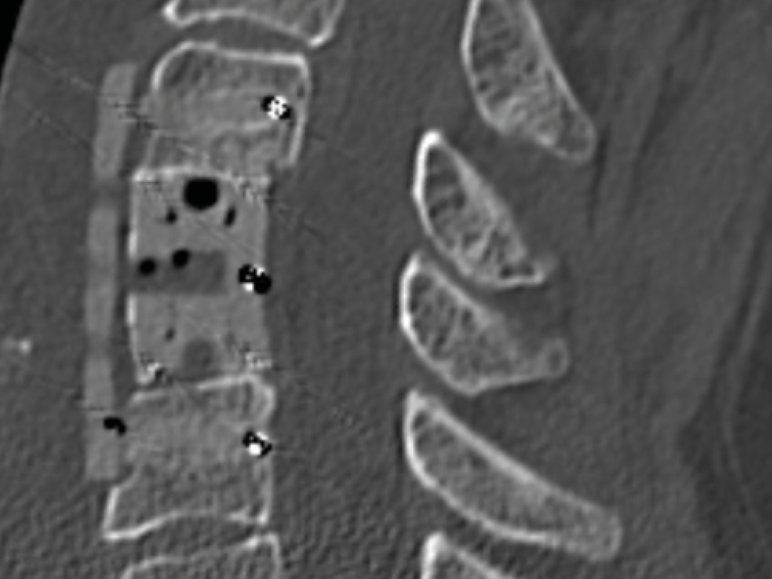 Increased Confidence in Making Decisions during Follow-up I icotec