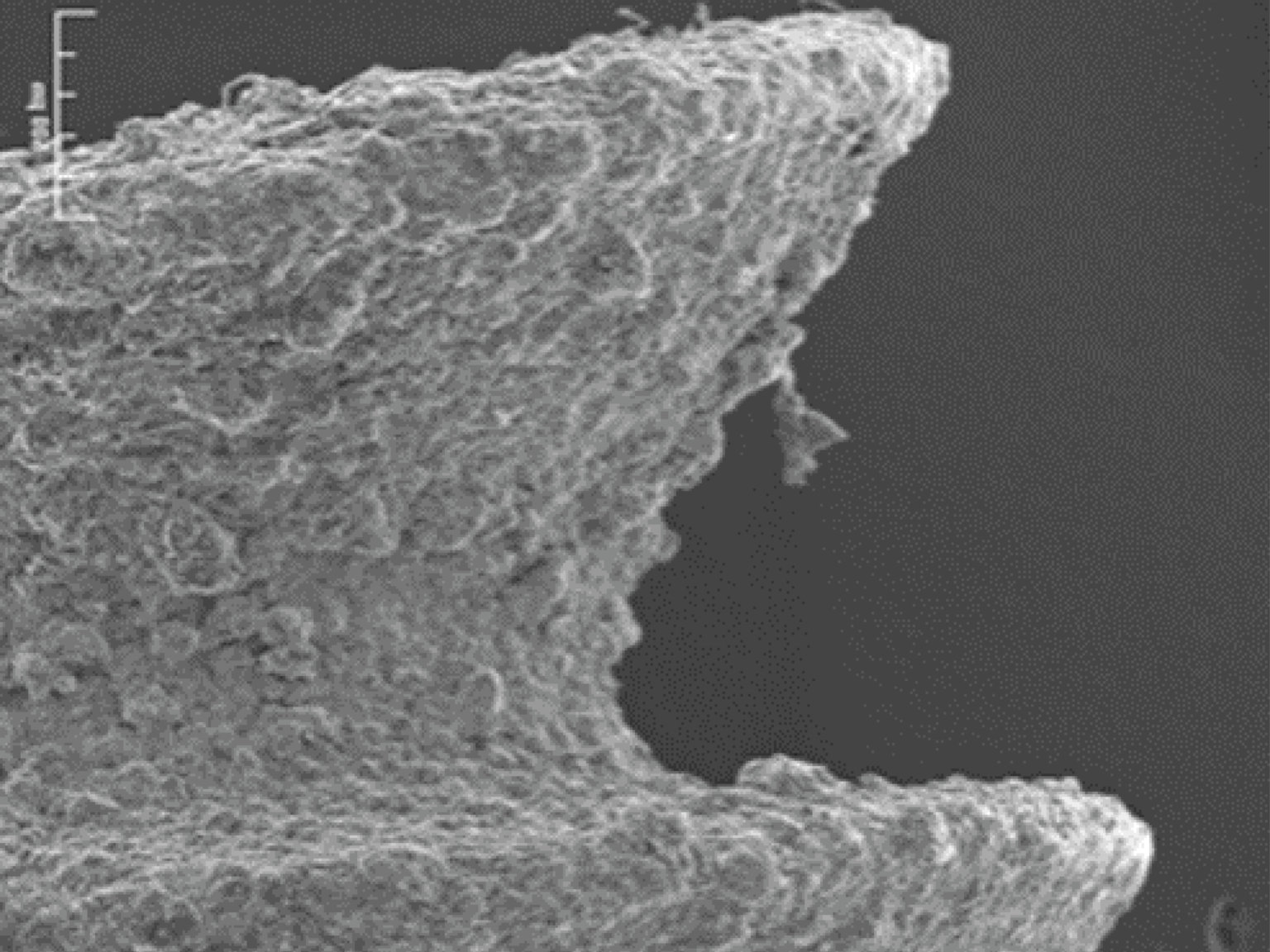 BlackArmor® Carbon/PEEK I icotec